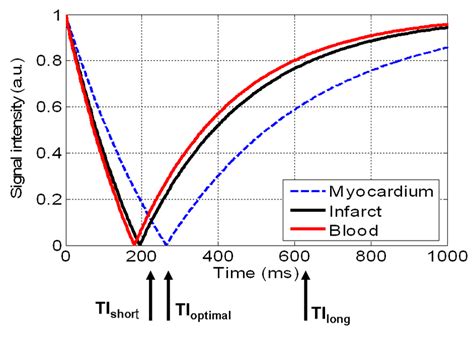 9 signal intensity curves illustrating the signal intensities at
