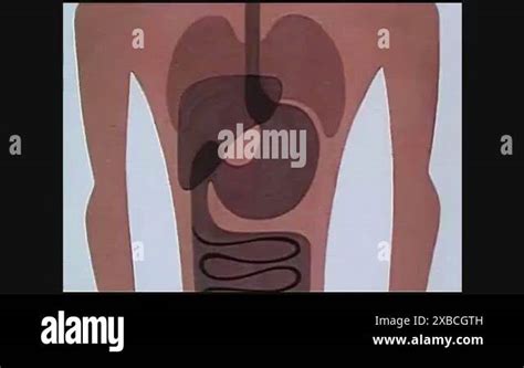 1963 Animation Is Used To Show How Cancer Cells Can Spread Stock