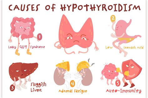 Causes Of Hypothyroidism Thyroid Healthcare Illustrations ~ Creative Market