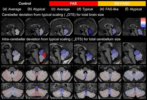 Mapping The Deviation From Typical Scaling VDTS In Selected