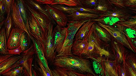 欣赏时髦的蛞蝓 — 二月最佳科学图片