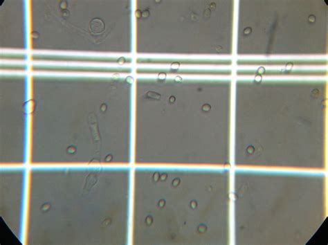 Could Somebody Suggest The Method Of Determining Trichoderma Or Other Fungi Spore Density