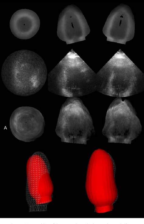 Figure 4 From P2a 6 Automatic Segmentation Of The Left Ventricle In 3d Echocardiography Using