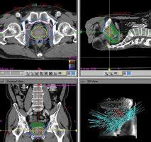 Icu Investigative And Clinical Urology