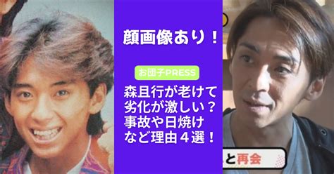 【顔画像】森且行が老けて劣化が激しい？事故や日焼けなど理由4選！ お団子press