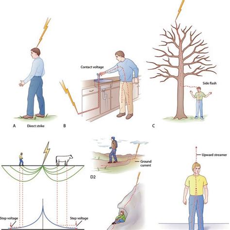 Mechanisms Of Lightning Injury A Direct B Contact C Download Scientific Diagram