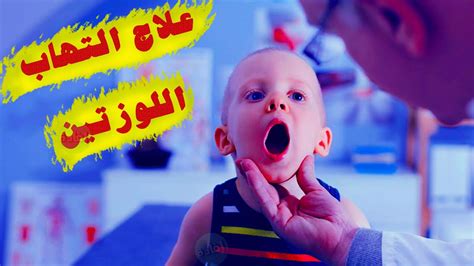 علاج التهاب اللوزتين عند الاطفال بدون مضاد Youtube