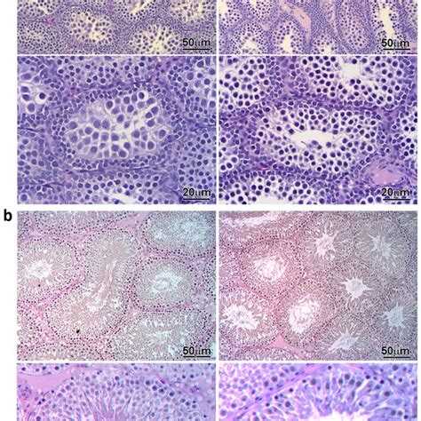 A Representative Micrographs Of Prepubertal And Adult Rat Testis
