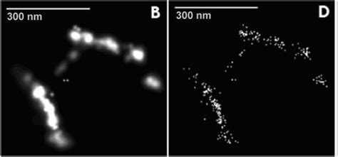 第一个被发现的病毒——烟草花叶病毒 Tmv 哔哩哔哩