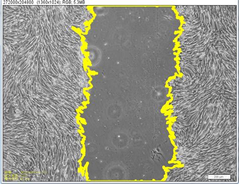 Imagej软件分析划痕实验（计算划痕面积及伤口愈合百分比） 神经生物学讨论版 丁香园论坛