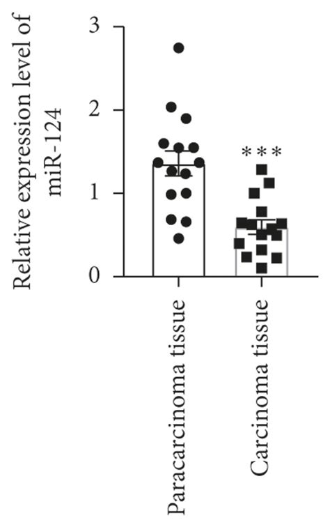 Malat1 Is Negatively Related To Mir 124 Expression In Cervical Tumor