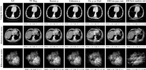 An Adversarial Learning Based Approach For Unknown View Tomographic Reconstruction