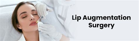 Lip Augmentation Surgery Arcus