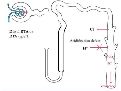 Renal Tubular Acidosis