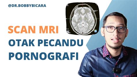 Perbandingan Scan Otak Melalui Pemeriksaan MRI Pecandu Pornografi Dan Orang Sehat YouTube