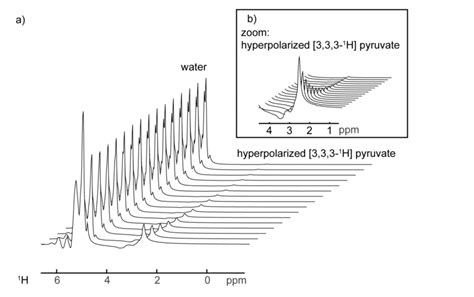 Dynamic 1 H Spectra Of Hyperpolarized [2 13 C]pyruvate Each Spectrum Download Scientific