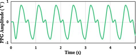 The Ppg Signal That Is Captured From A Patients Finger During The
