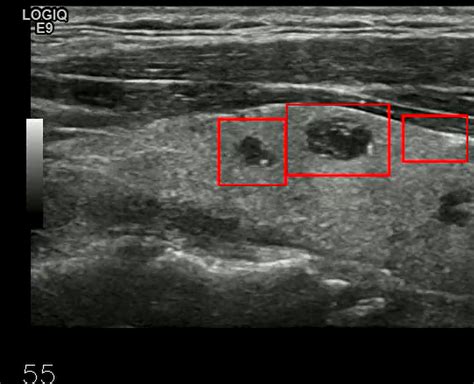 【开发技术】net使用ffmpeg视频特定帧上绘制内容ffmpeg Roi Csdn博客