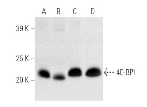 4e Bp1 Antibody P 1 Scbt Santa Cruz Biotechnology