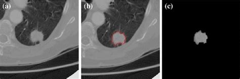 Manual Segmentation Process Of A Pulmonary Nodule From The Lidc A Ct Download Scientific