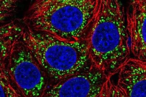 A Study Found Cells That Connect Inflammatory Bowel Disease And Long