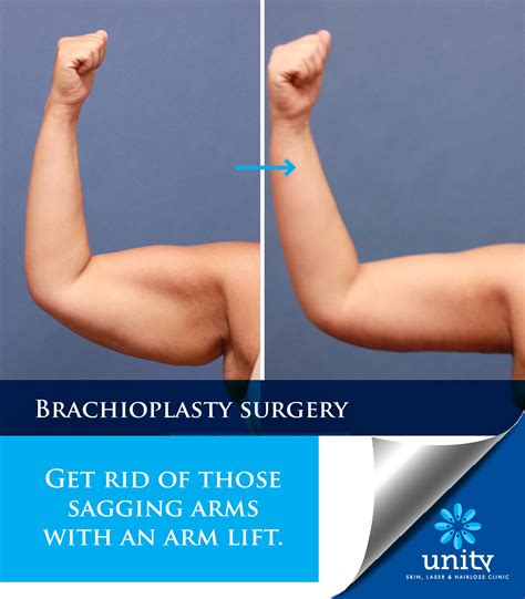 tired of those sagging arms get rid unity skin clinic