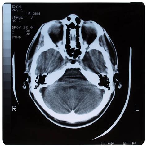 50805937 Xray Stock Illustrations Depositphotos