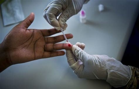 All You Need To Know About Hiv Testing