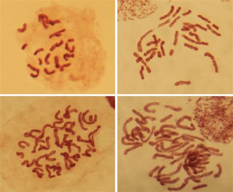 Diploid 2n A Triploid 3n B Tetraploid 4n C And Pentaploid 5n