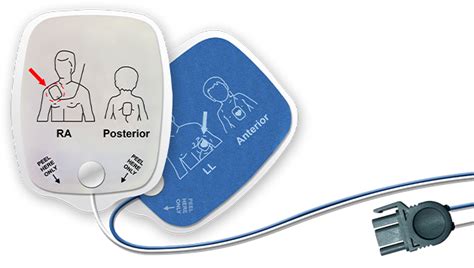 Heartsync Defibrillation Electrodes