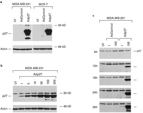 Western Blot Analysis Of P27 And Actin Proteins In Mda Mb 231 And Mcf 7