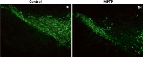 Mptp Induced Dopaminergic Neurotoxicity In Animals Mice Received