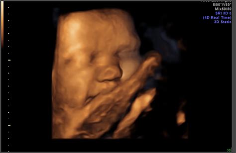 40 гестационна седмица от бременността