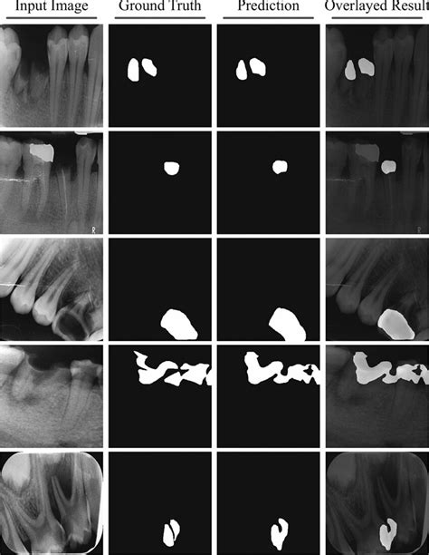 Qualitative Results Of Proposed Self Supervised Learning Strategy For Download Scientific