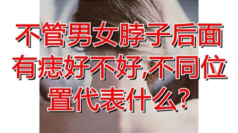 不管男女脖子后面有痣好不好不同位置代表什么 Youtube