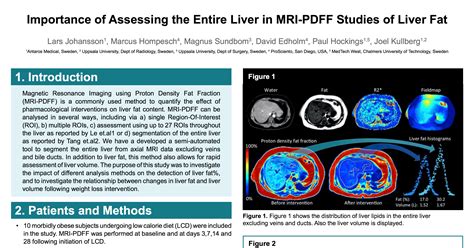 Importance Of Assessing The Entire Liver In Mri Pdff Studies Of Liver