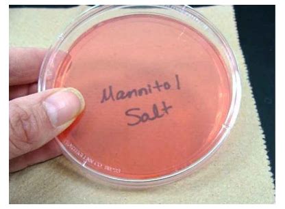 Differential Selective And Enriched Media Flashcards Quizlet