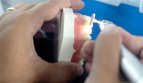 Gc Composite Injection Protocol Medimatch Dental Laboratory