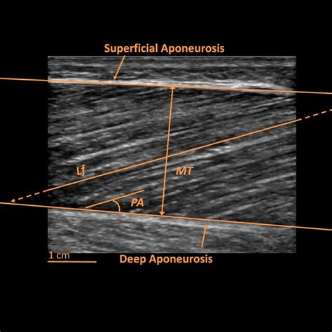 Longitudinal B Mode Ultrasound Snapshots And Respective Efov Scans For