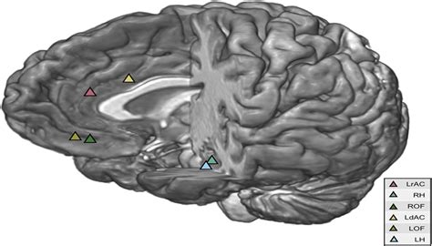 Neurosurgery