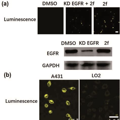 A Confocal Imaging Of Egfr Knockdown A431 Cells Egfr Knockdown A431