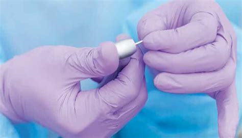 Application Of Cvek Pulpotomy In Treating Head And Neck Radiation Cases
