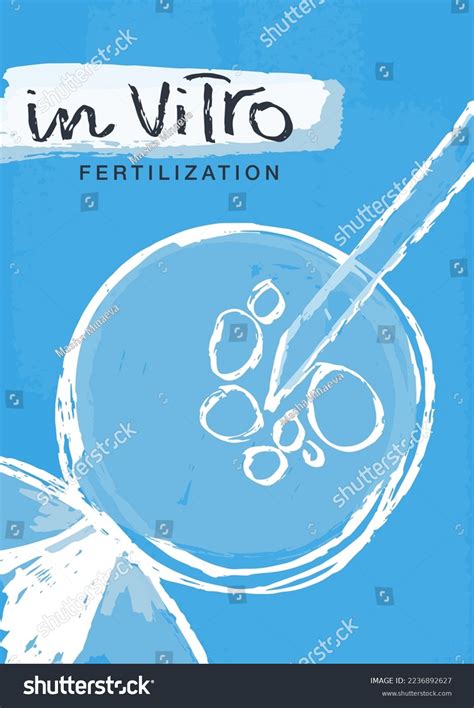 Vitro Fertilization Process Abstract Medical Illustration Stock Vector