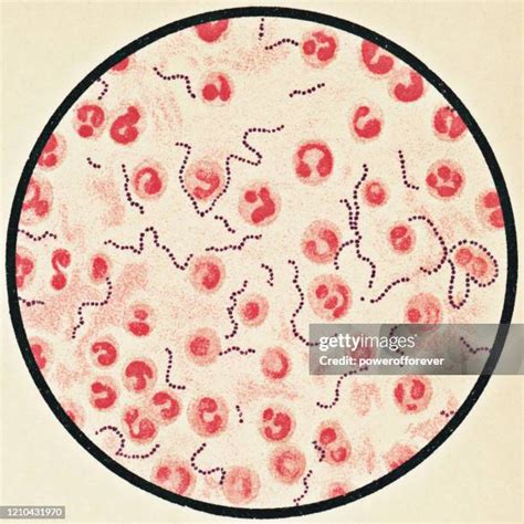 Streptococcus Pyogenes Colony Morphology