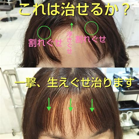 前髪割れる方必見！ 美容室 Aejon八幡山店 ブログ