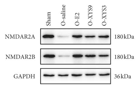 Effect Of Xiao Yan San Xys On Expression Of Nmdar2a And Nmdar2b In