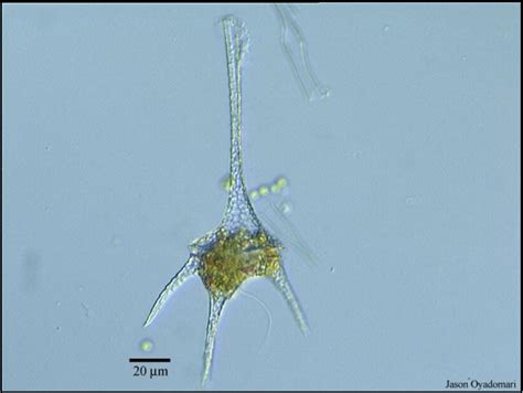 Ceratium Under Microscope