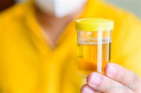 95后女孩口吐黑水查出罕见病，只有五万分之一的概率！ 知乎