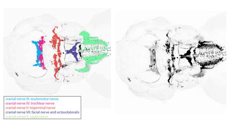 Oculomotor Nucleus Brain