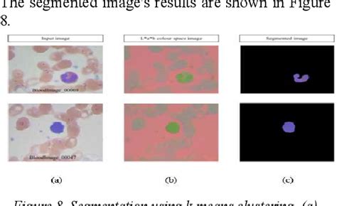 Figure 1 From Automatic Detection And Classification Of Leukemia From